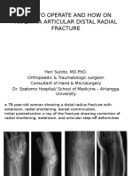 Frykman Classification of Distal Radius Fractures | PDF