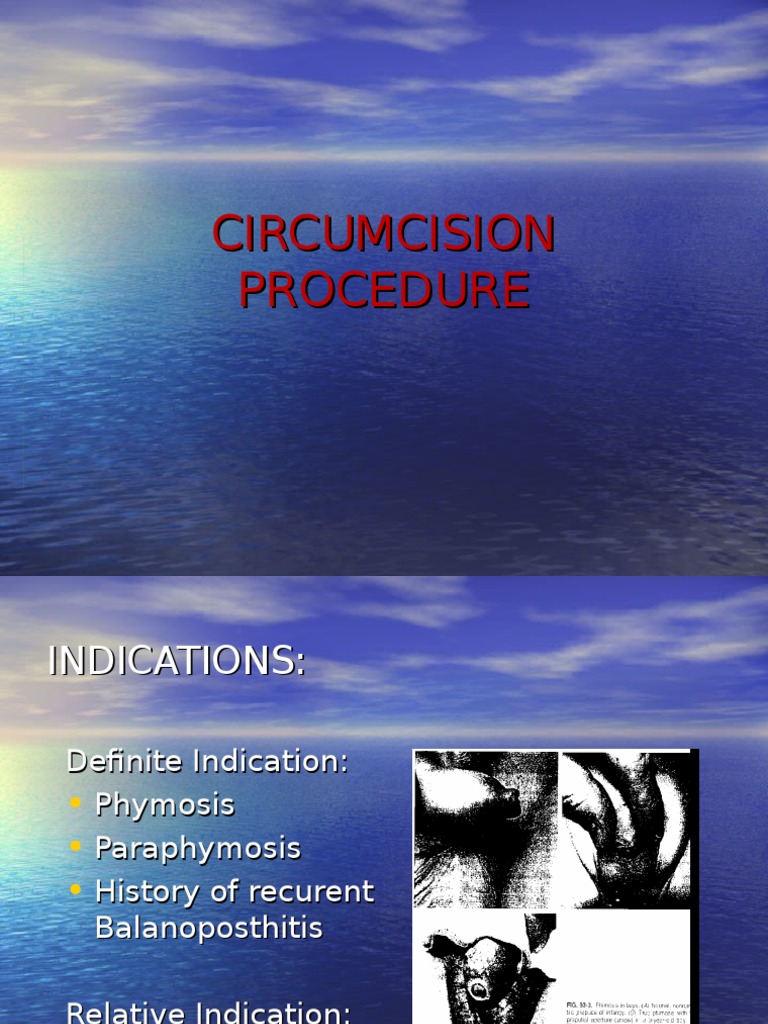 Circumcision Procedure | PDF | Penis | Surgery