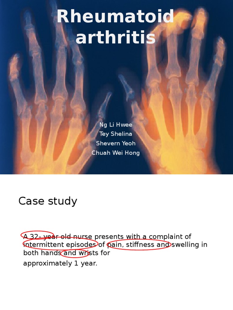 Rheumatoid Arthritis Pdf Rheumatoid Arthritis Arthritis