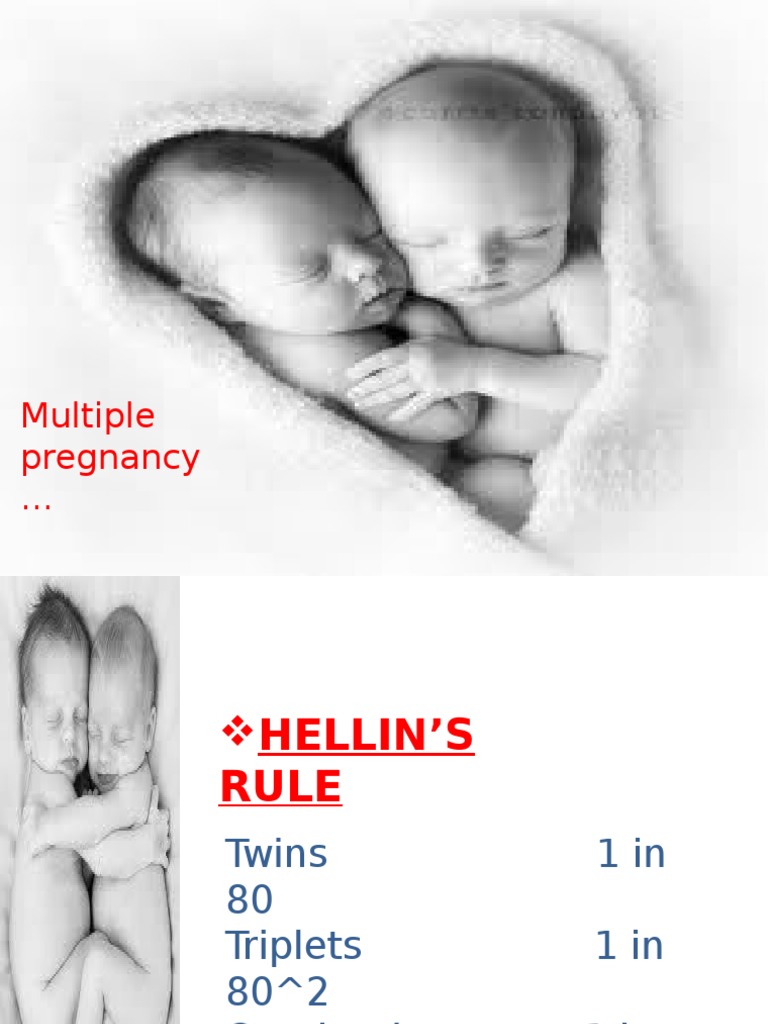 Multiple Pregnancy3 | PDF | Twin | Fetus