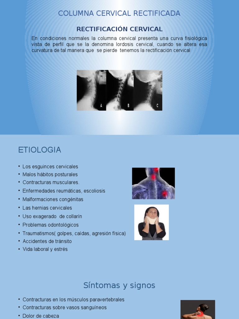 Columna Cervical Rectificada | PDF | Hombro | Músculo