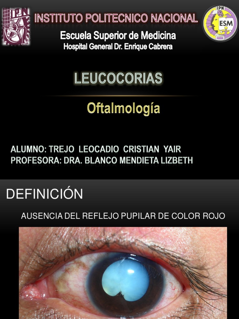 Leucocorias | PDF | Ojo humano | Cáncer
