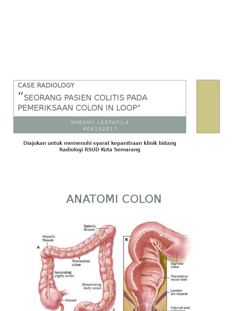 Case Colon in Loop | PDF