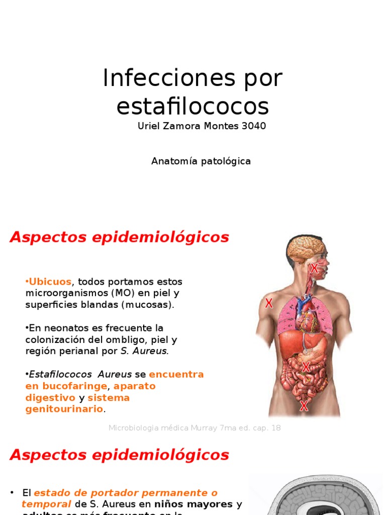 Infecciones Por Estafilococos | Staphylococcus Aureus | Anticuerpo