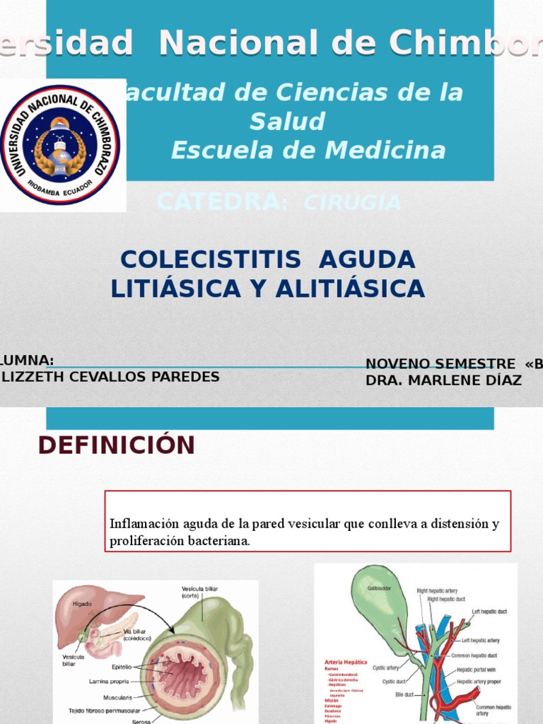 Colecistitis Aguda Litiasica y Alitiasica | Gallbladder | Organ (Anatomy) Colecistitis Aguda Litiasica y Alitiasica | Gallbladder | Organ (Anatomy)