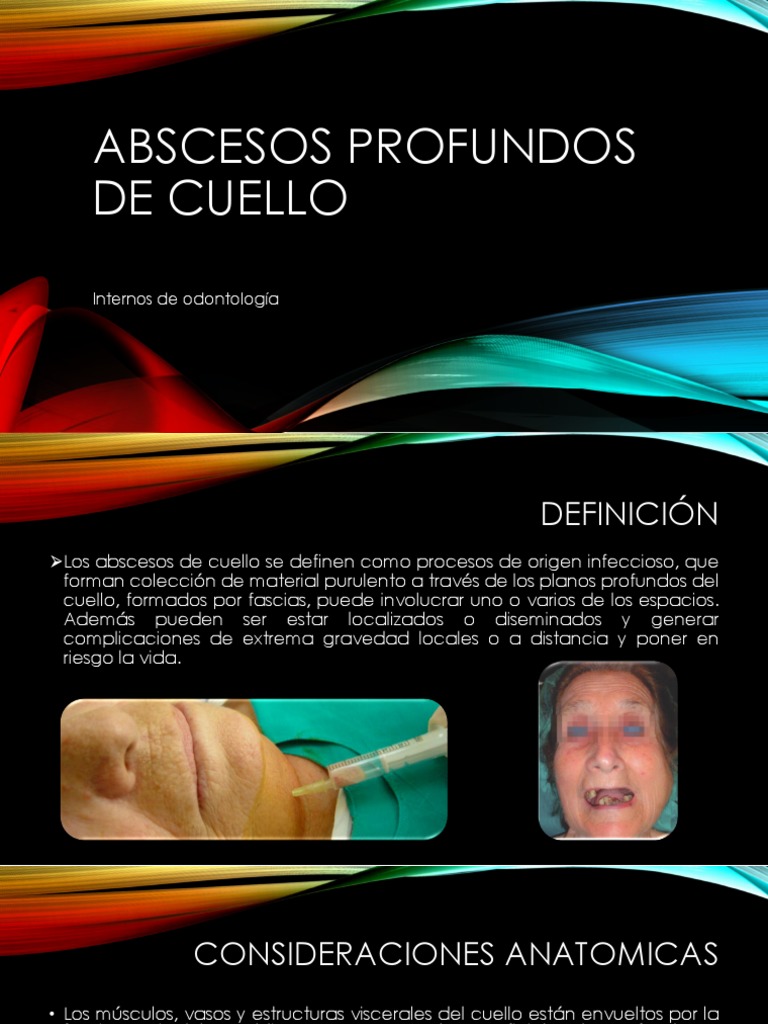 Abscesos Profundos de Cuello | PDF | Ct Scan | Ganglio linfático