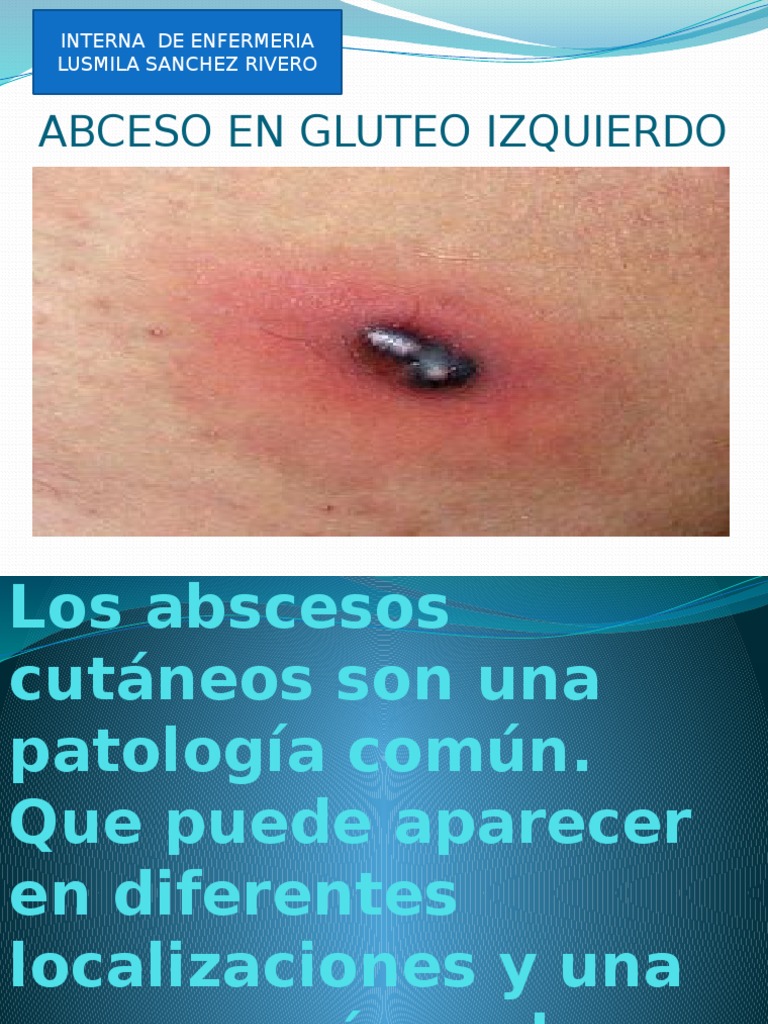 Manejo del absceso en glúteo izquierdo | PDF | Rtt | Enfermedades y ...