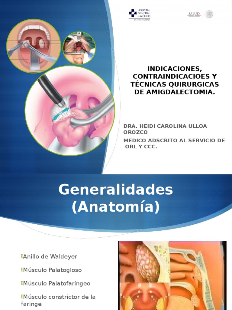 Amigdalectomia | PDF | Especialidades Medicas | Medicina