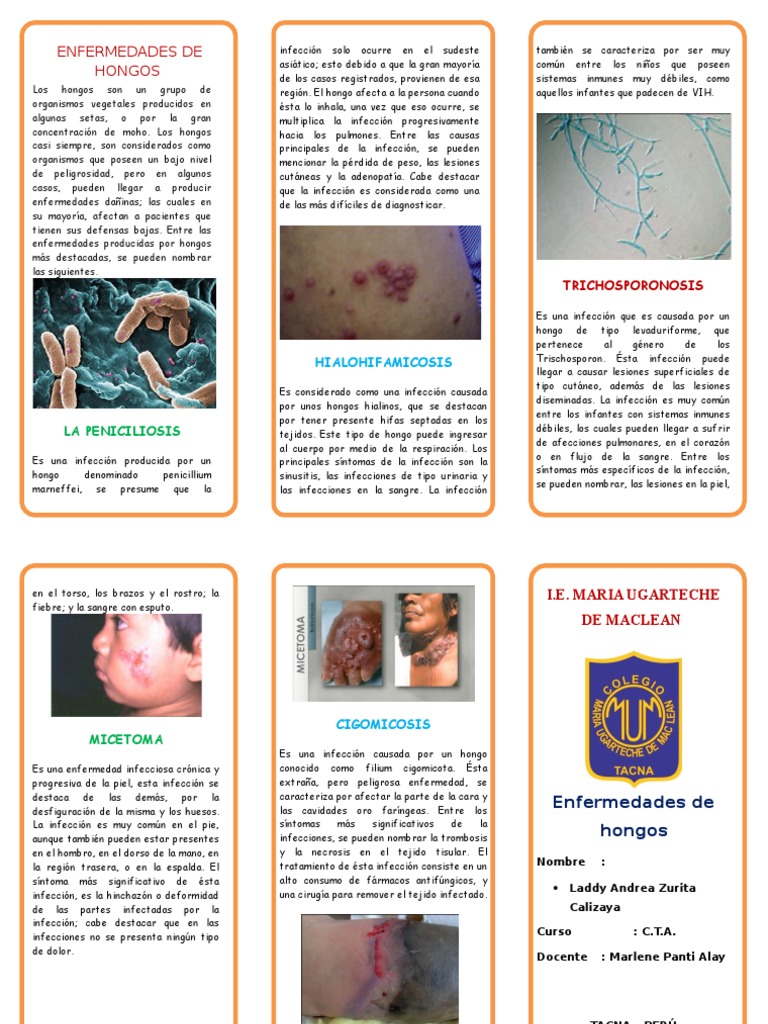 Enfermedades de Hongos | PDF | Hongo | Infección