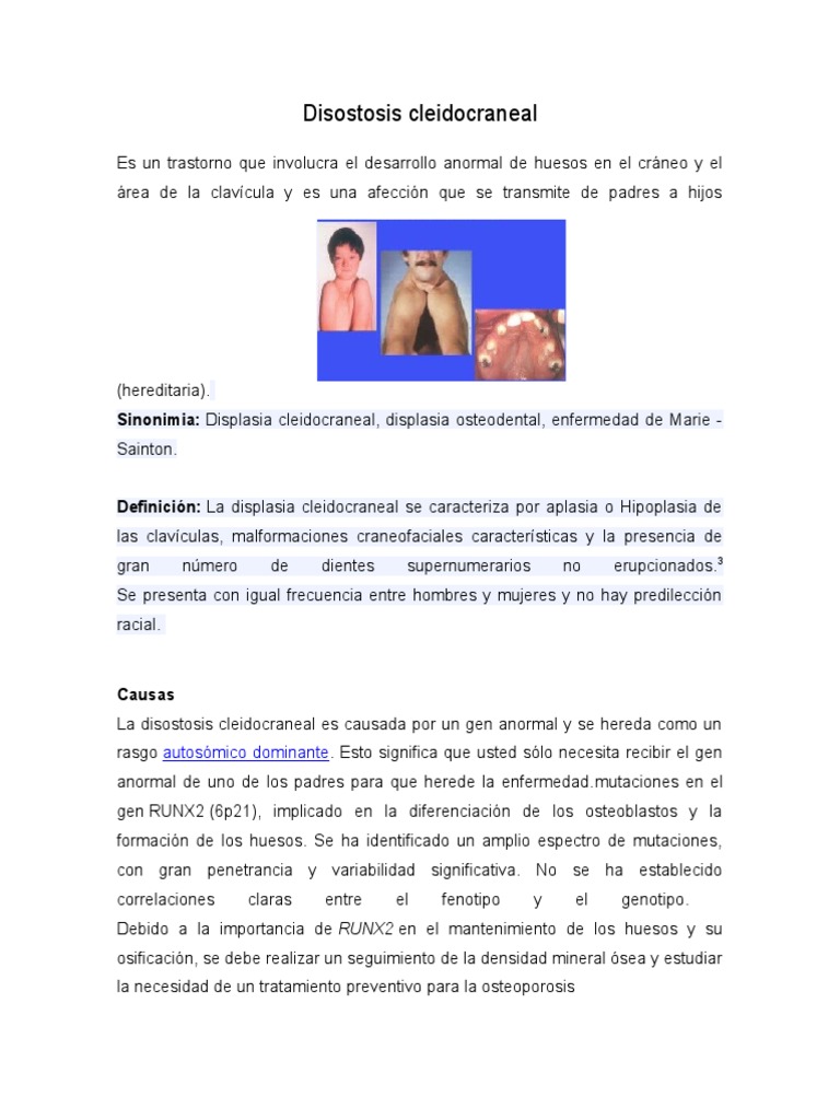 Disostosis-Cleidocraneal Finaaaaaaaal | PDF | Diente humano | Cráneo