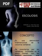 Signo de Risser | PDF | Escoliosis | Rtt