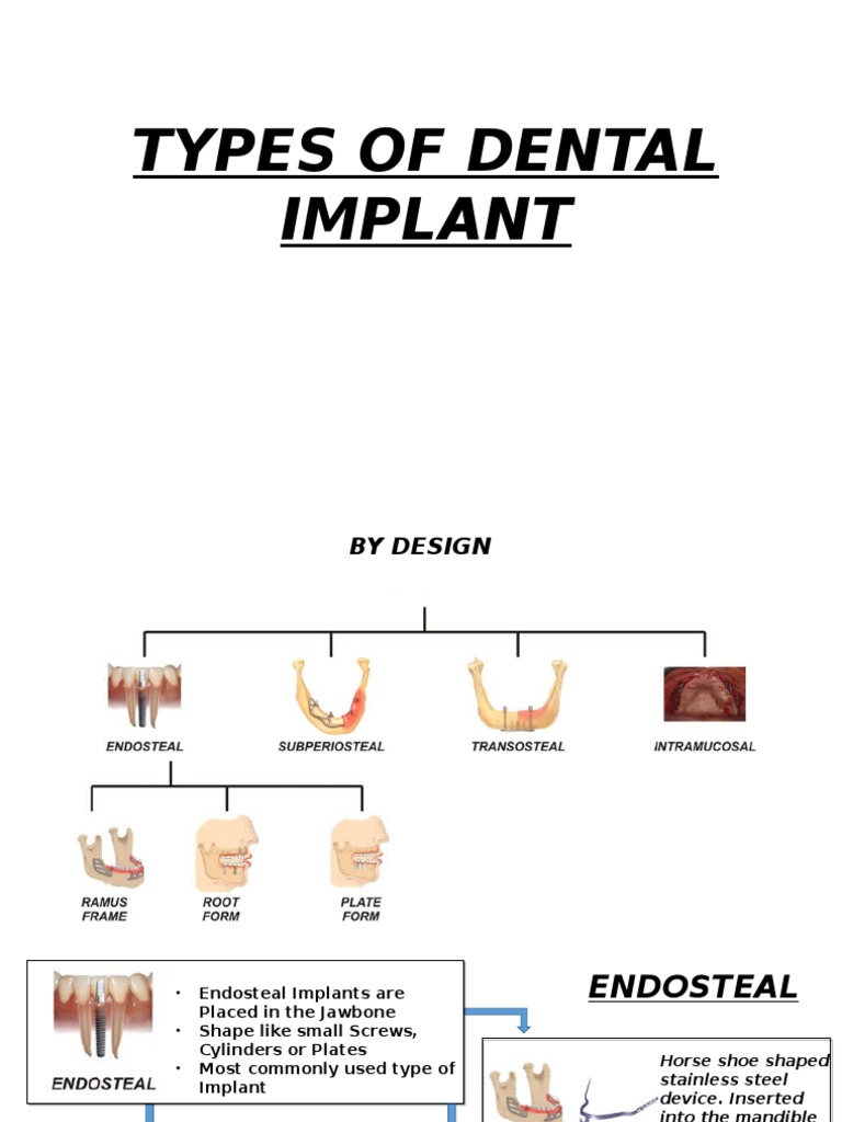 Types and Classification of Dental Implants | PDF | Home & Garden
