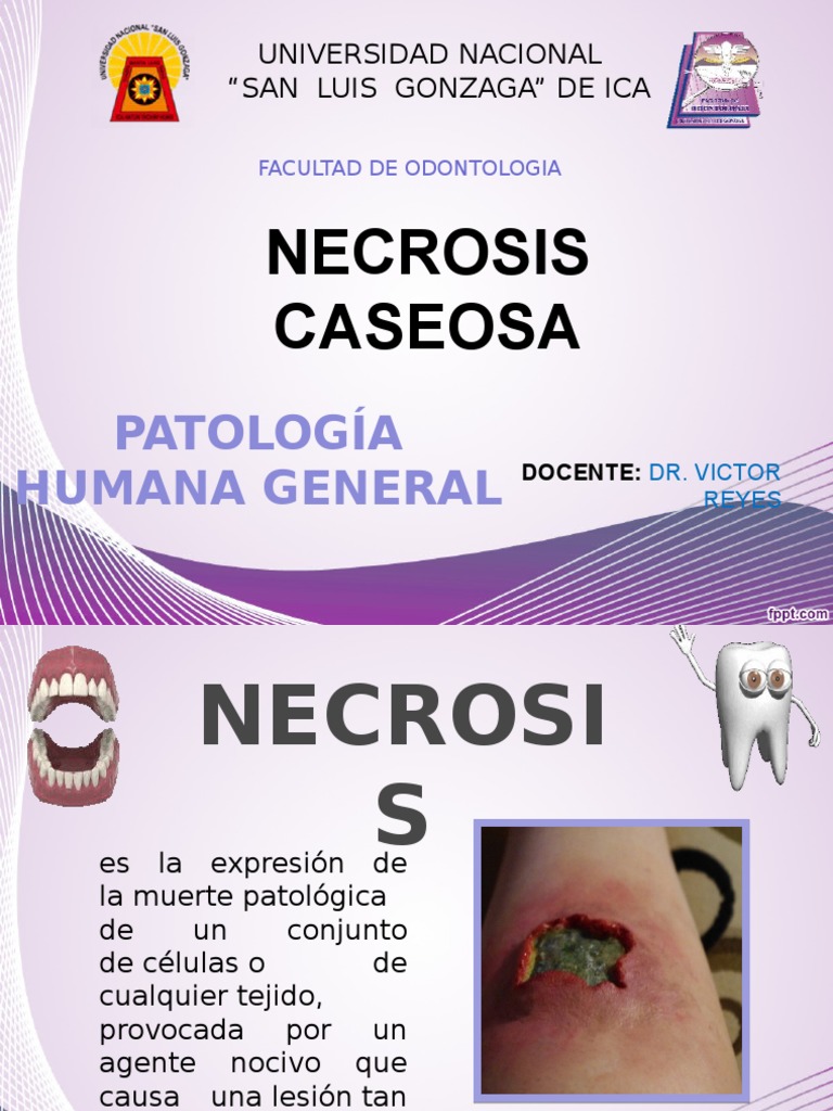 Necrosis Caseosa Pato | Tuberculosis | Medicina CLINICA