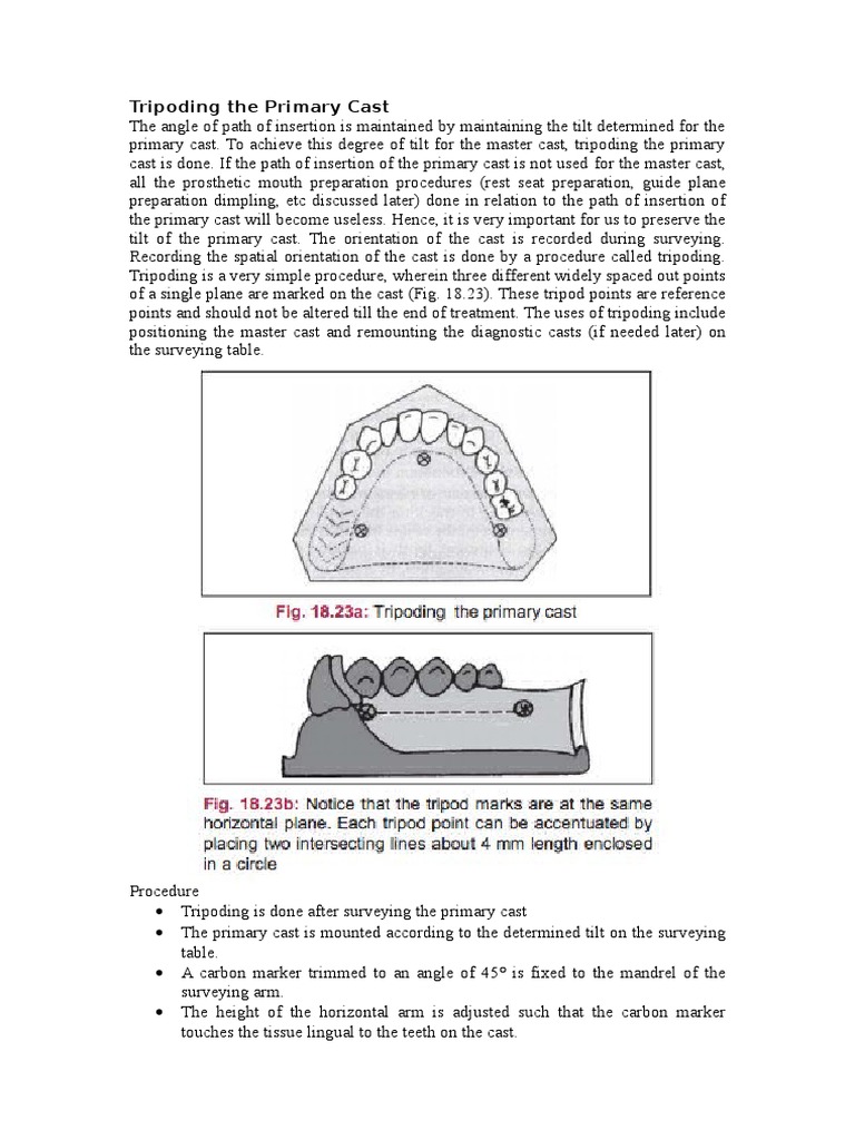 Tripoding the Primary Cast | Dentures | Tooth