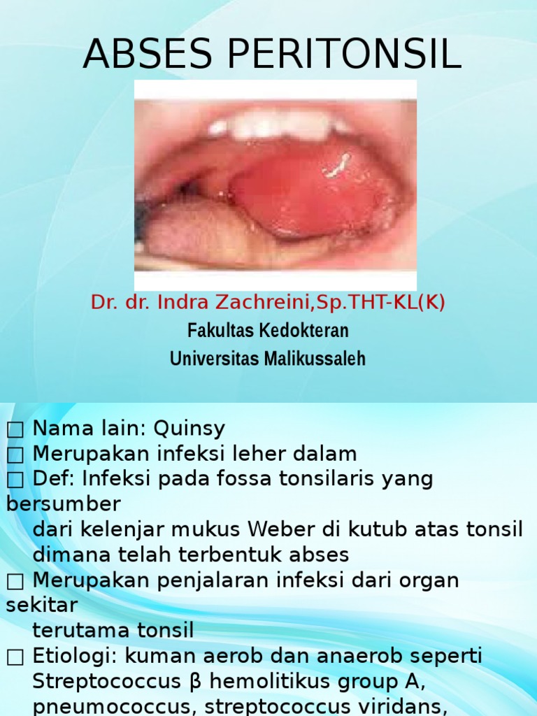 Abses Peritonsil | PDF | Seni