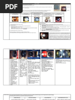 NS Grading of Cataract | PDF
