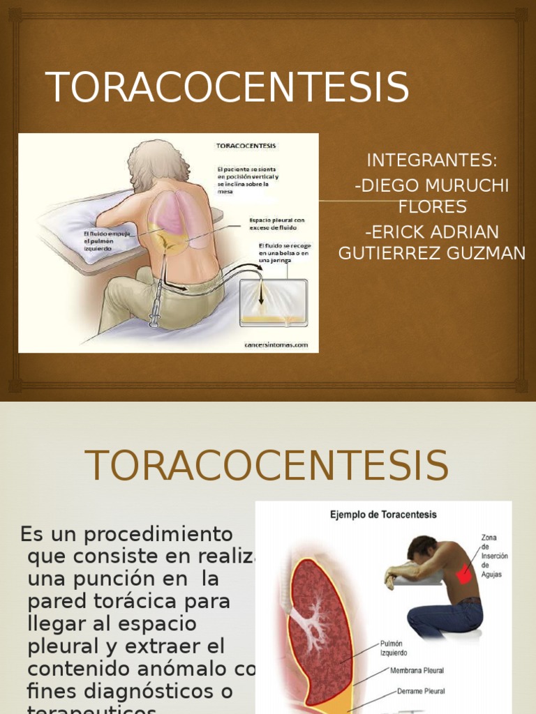 Toracocentesis | PDF | Ciencia y matemáticas