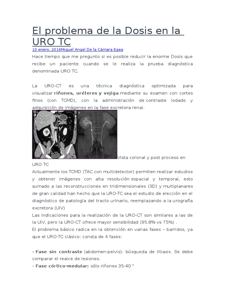 El Problema de La Dosis en La UROTEM | PDF | Ct Scan | Especialidades ...