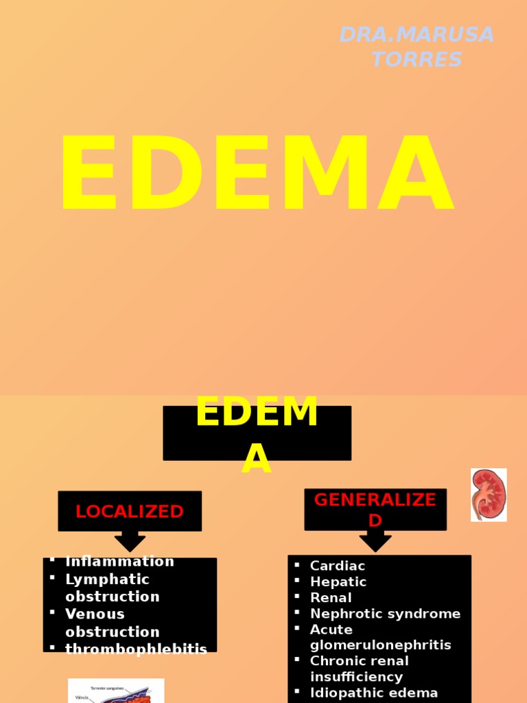 Classification, Causes, Diagnosis, Complications and Treatment of Edema ...