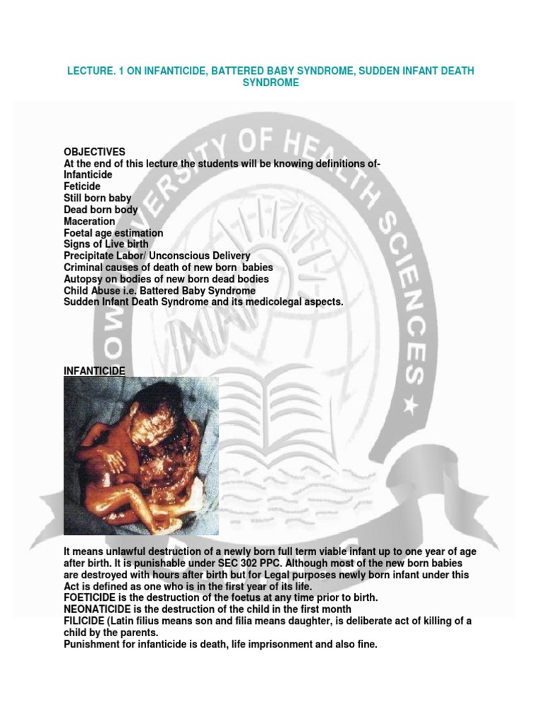 Lecture. 1 On Infanticide, Battered Baby Syndrome, Sudden Infant Death Syndrome | PDF | Lung ...