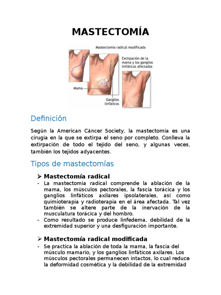 Tipos de Mastectomía y Complicaciones | PDF | Hombro | Cáncer de mama