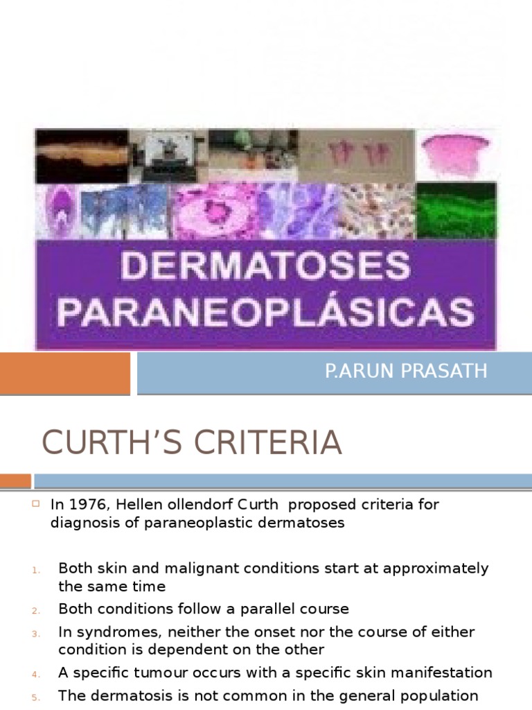 Paraneoplastic Dermatoses | PDF | Cancer | Neoplasms