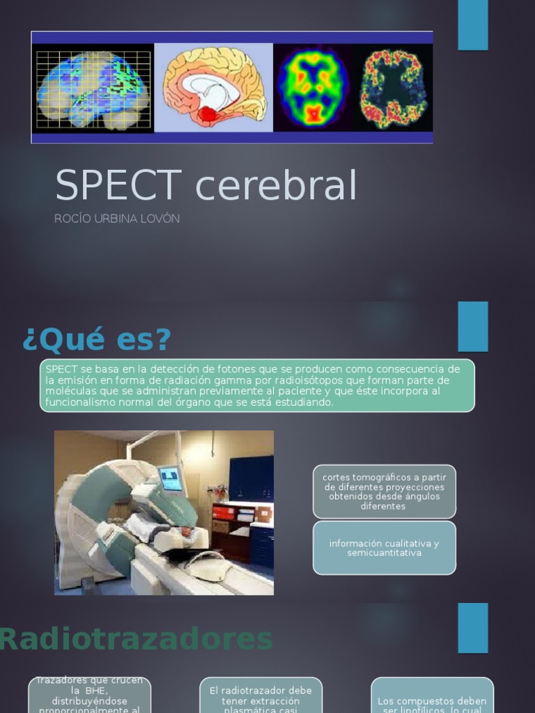 SPECT Cerebral | PDF | Enfermedad de Alzheimer | Isquemia