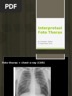 Teknik Pemeriksaan CT Scan-Thorax | PDF | Ct Scan | Lung