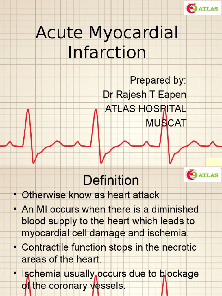 Myocardial Infarction | PDF | Myocardial Infarction | Angina Pectoris