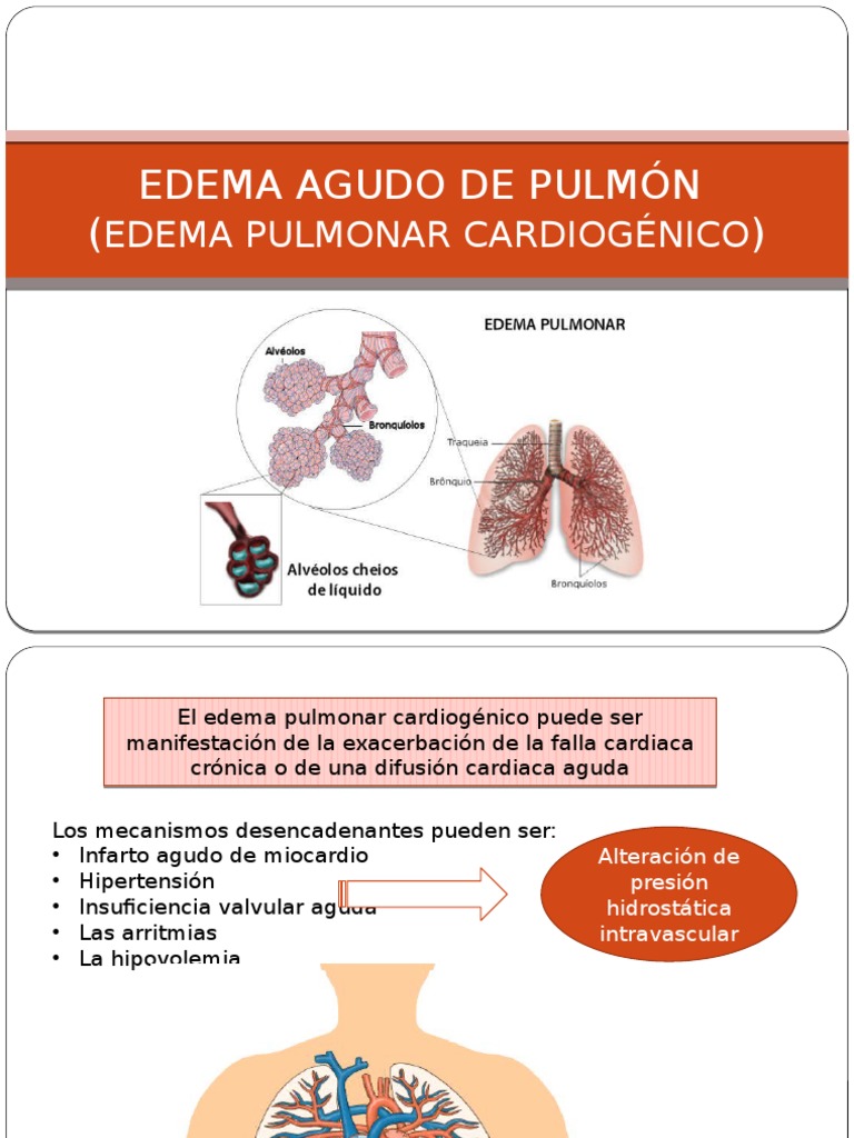 Edema Agudo de Pulmón | PDF | Edema | Músculo cardíaco