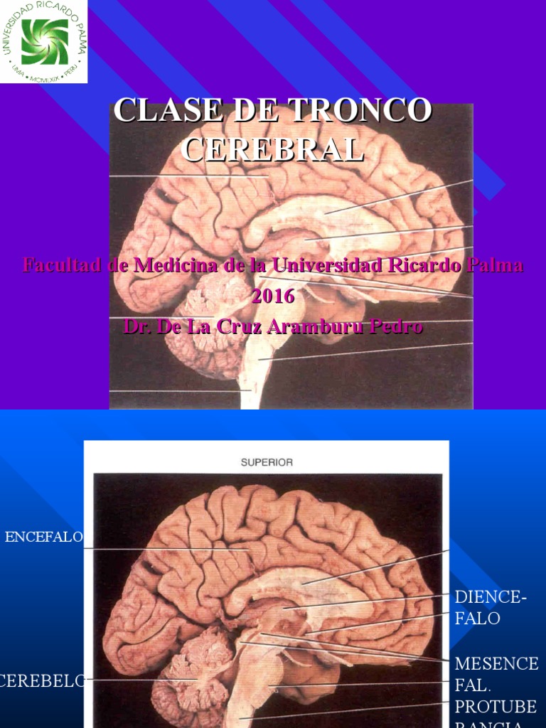 Clase de Tronco Encefalico Completo (III) . | PDF | Cerebelo | Anatomia animal