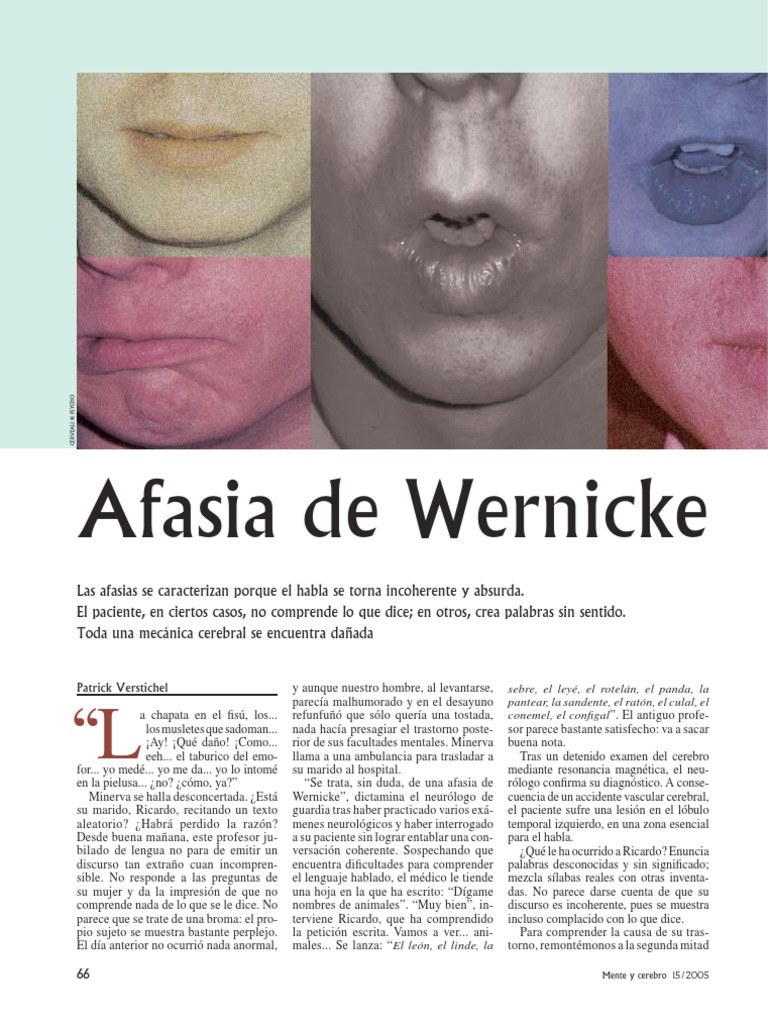 afasia de wernicke (1).pdf | Afasia | Cerebro
