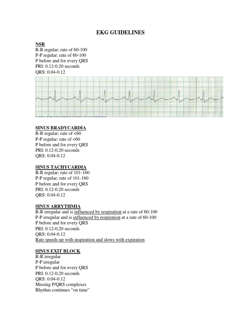 Ekg Guidelines | PDF | Ventricle (Heart) | Cardiac Arrhythmia