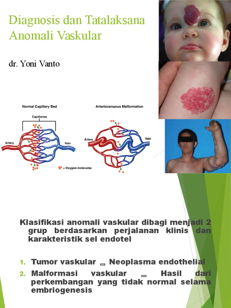 Anomali Vaskular Weng | PDF | Sains & Matematika