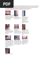 Suture Chart Ethicon | PDF | Surgical Suture | Chemical Substances