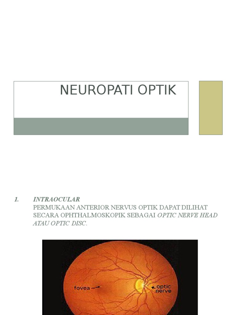 Neuropati Optik (Ika) | PDF