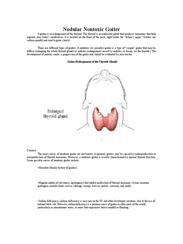 Nontoxic Goiter | PDF | Thyroid | Organ (Anatomy)