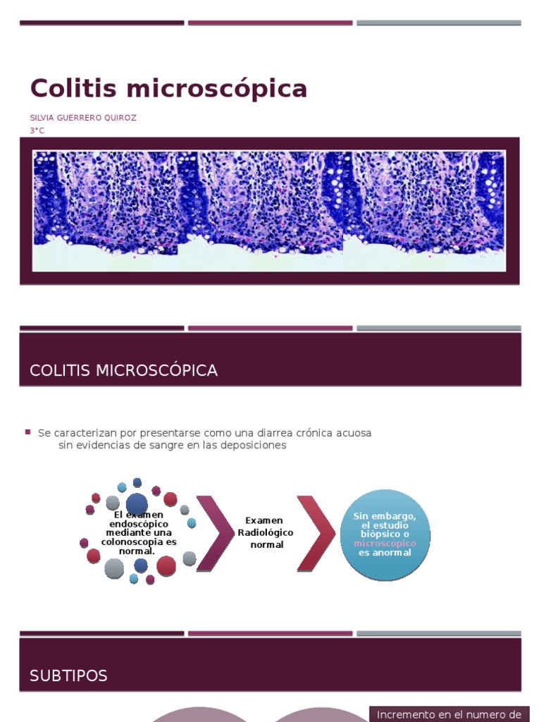 Colitis Microscópica | Diarrea | Epitelio