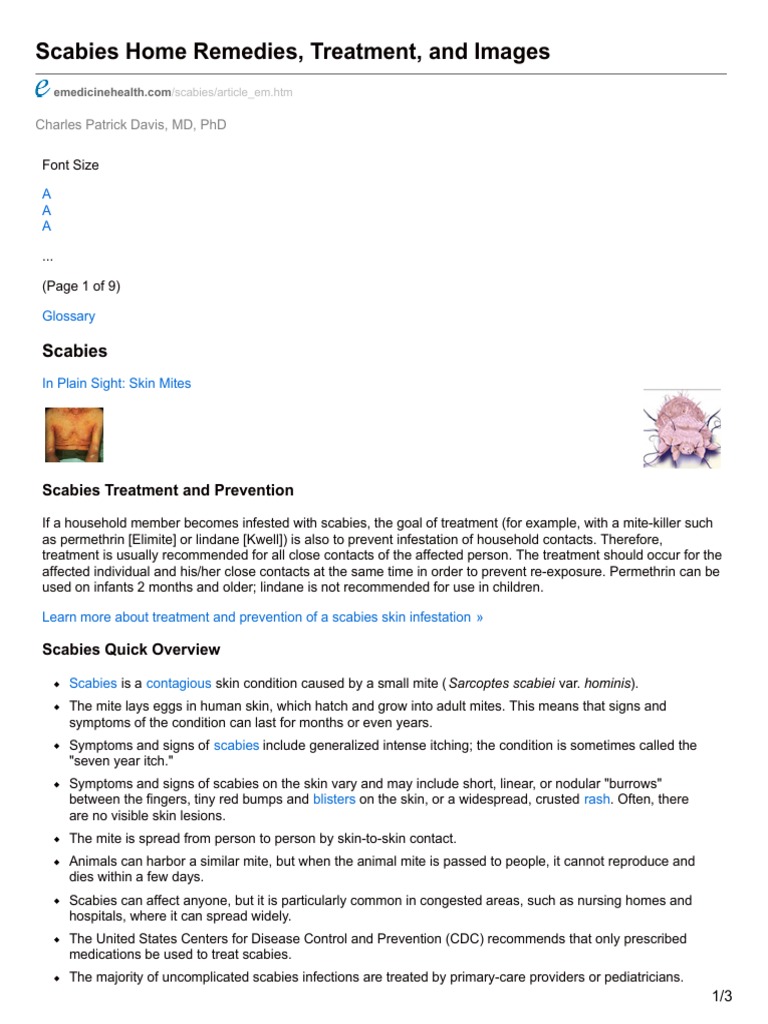Scabies: Causes, Treatment, and Prevention | PDF | Rtt | Medicine