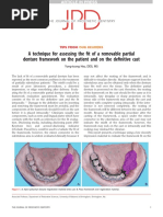 Intrapapillary Injection Technique For Children | PDF | Tooth ...