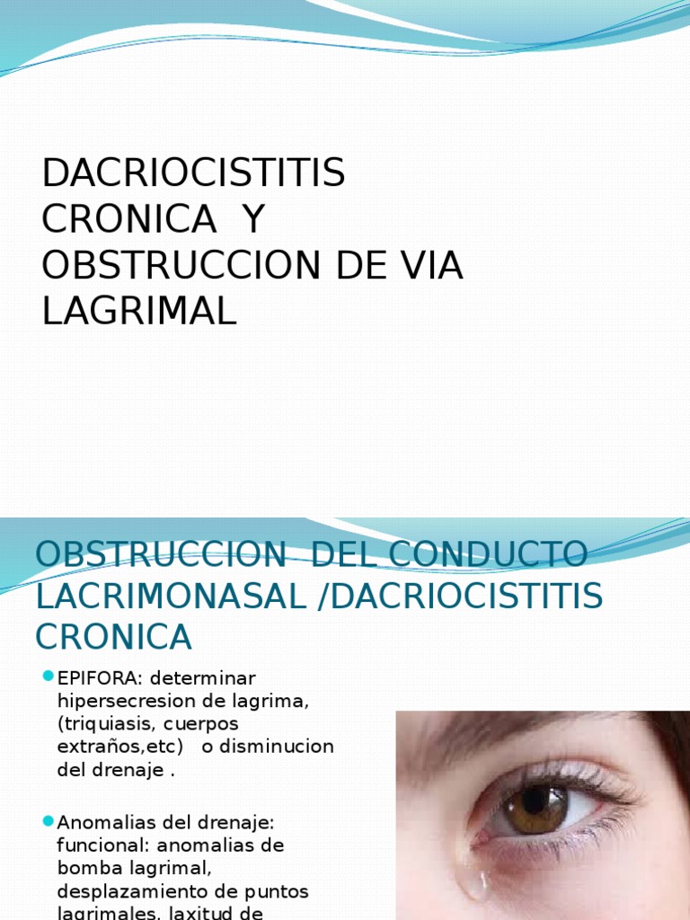 Dacriocistitis Cronica | Especialidades Medicas | Enfermedades y trastornos