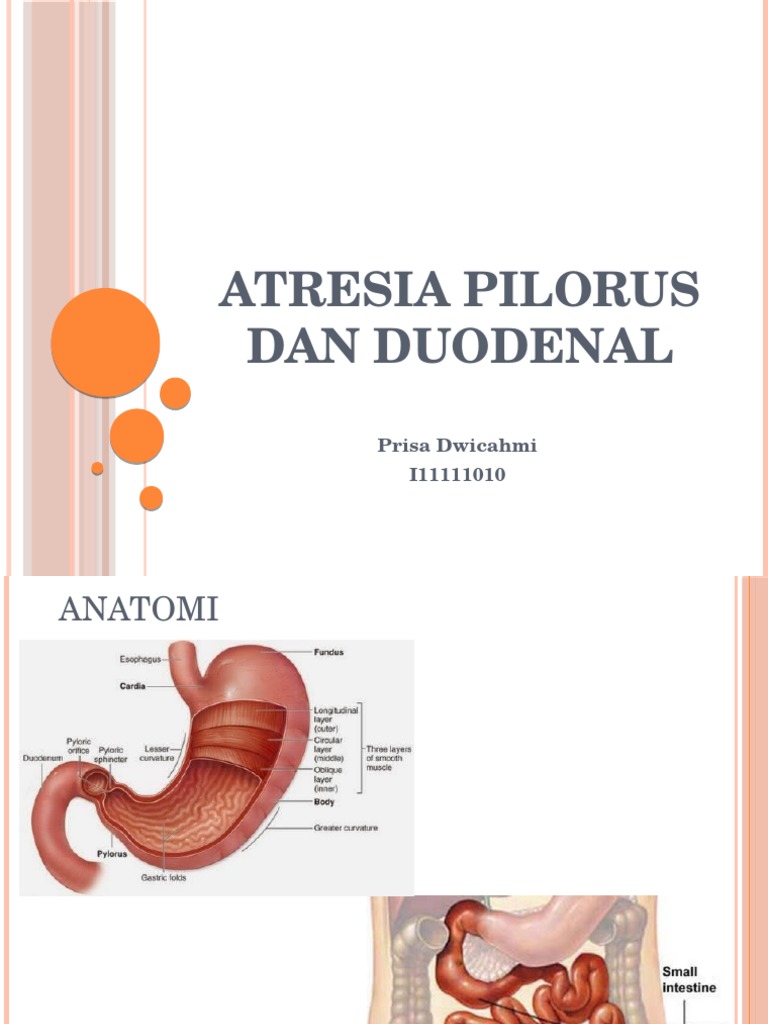 Atresia Pilorus Dan Duodenal | PDF