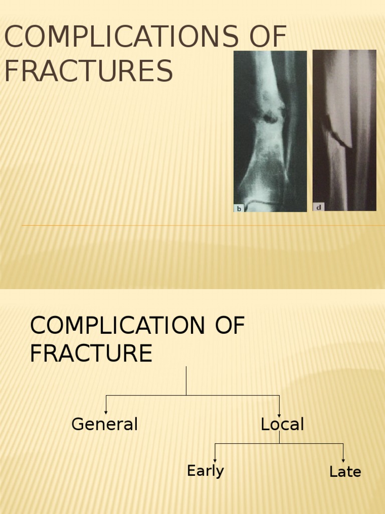 Complications of Fractures | Ischemia | Wound
