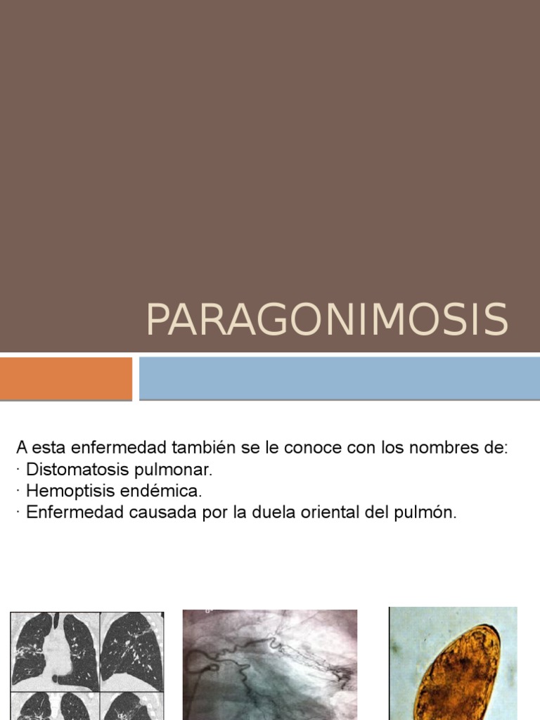 Paragonimosis: Enfermedad Pulmonar Zoonótica | PDF | Tos ...