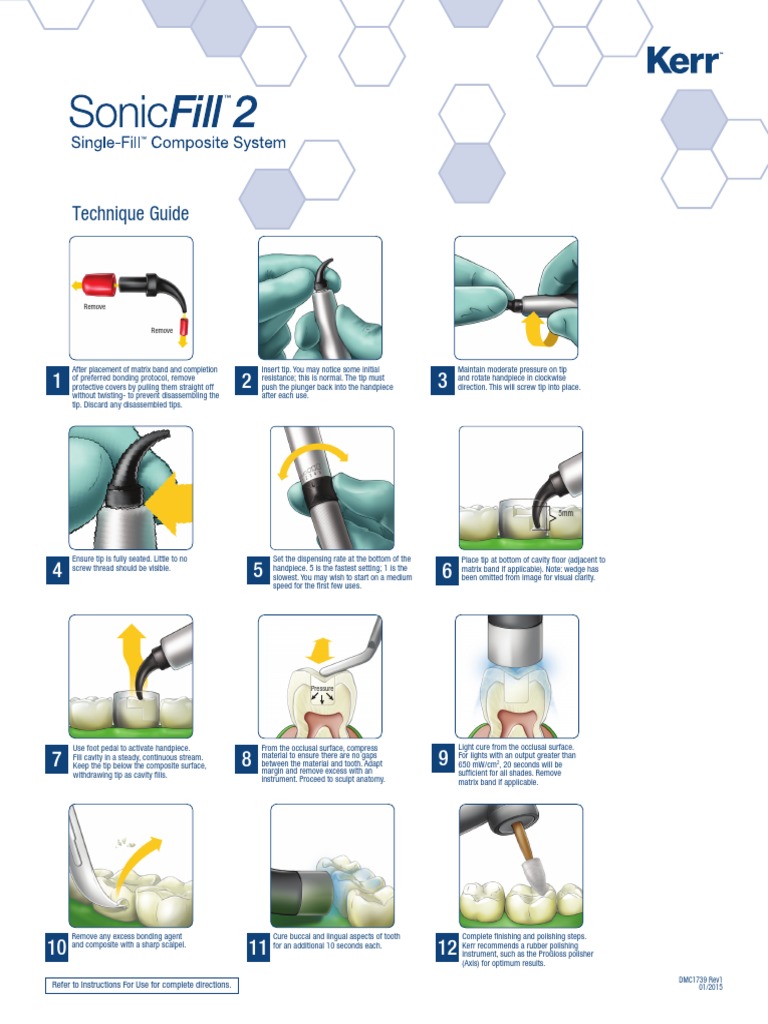 SonicFill 2 Technique Guide | PDF