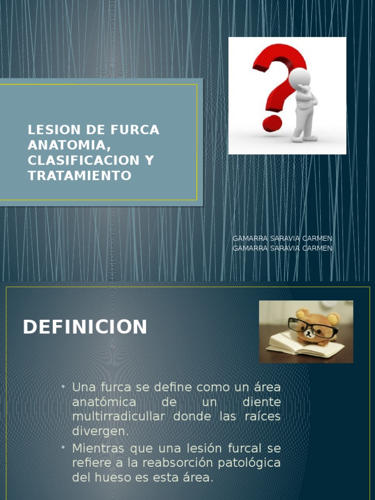 Lesion de Furca Anatomia, Clasificacion y Tratamiento