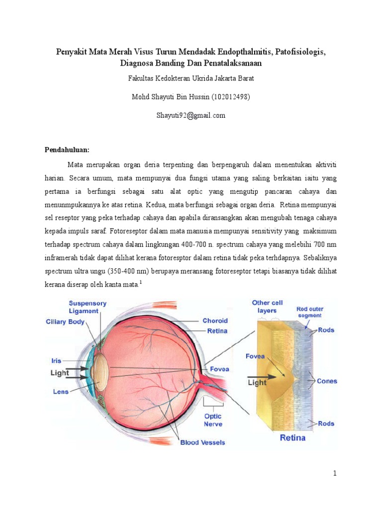 Penyakit Mata Merah Visus Turun Mendadak Endopthalmitis | PDF | Sains ...