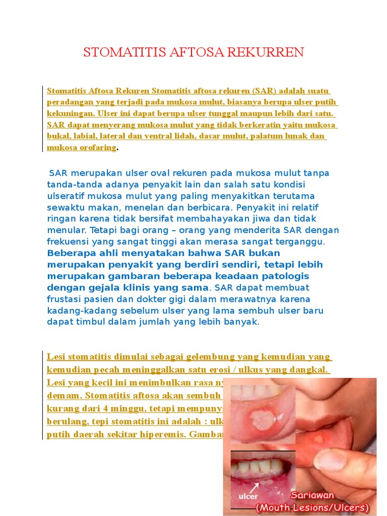 Stomatitis Aftosa Rekurren Step 5 | PDF | Sains & Matematika