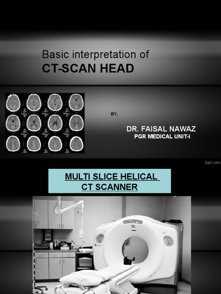 C.tscan Pathology by Faisal | PDF | Thrombosis | Cerebrospinal Fluid