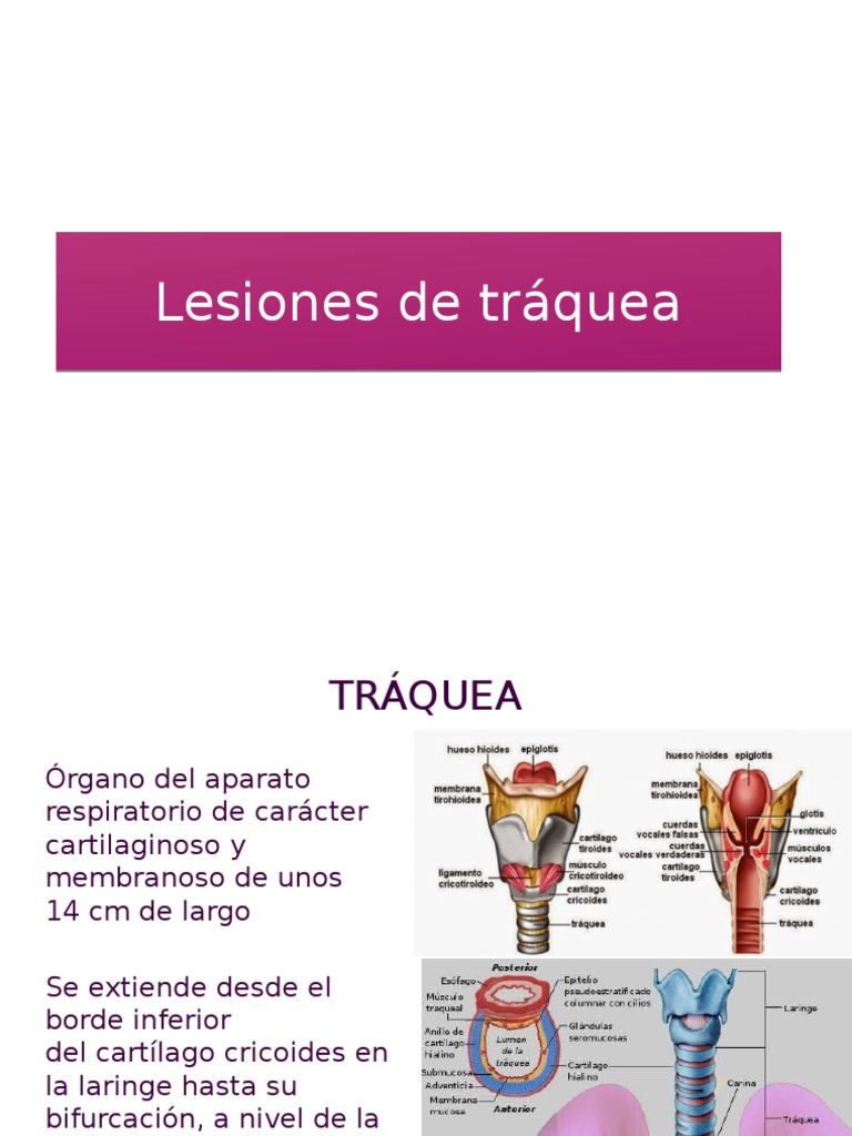 Lesiones y complicaciones de la tráquea | PDF | Especialidades Medicas ...